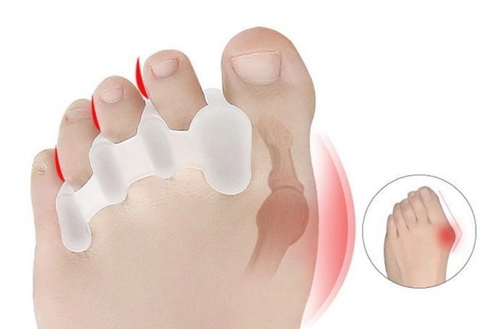 마스크·건강용품 실리콘 발가락링 발가락 벌리기 입문용 새끼 엄지발가락 휨 오늘의집 쇼핑